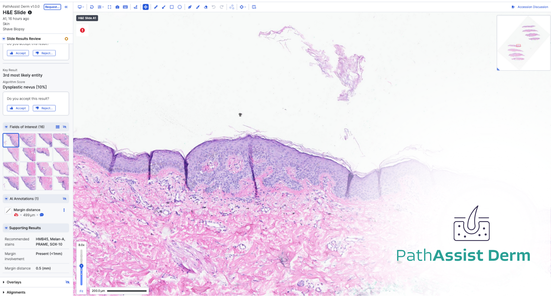 Introducing PathAssist Derm